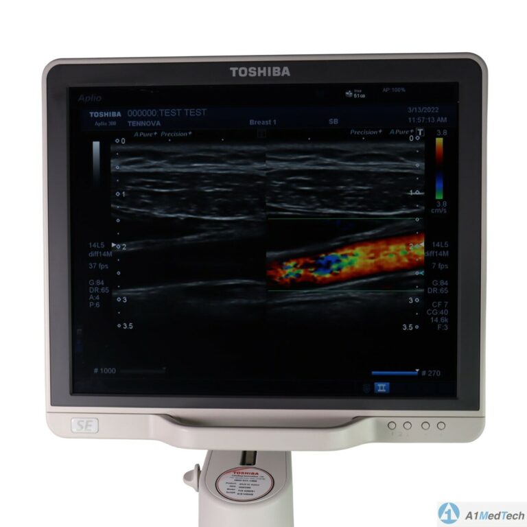 Toshiba Aplio 300 Ultrasound Machine - PERKASA MEDICAL